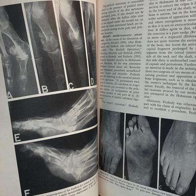 Vintage 1965 Medical Reference Book Deformities of the Foot Illustrated ...